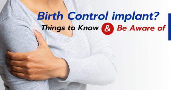Birth Control implant? Things to Know & Be Aware of | Chiangmai ...