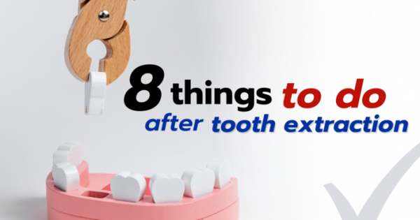 8 things to do after “tooth extraction” | Chiangmai Hospital | Tel ...