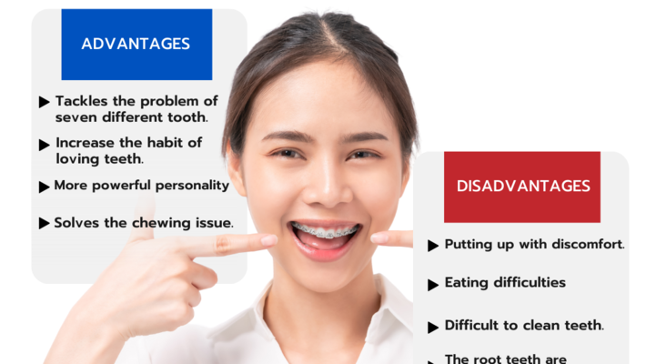 Comparing the advantages and disadvantages of Comparing the advantages and disadvantages of