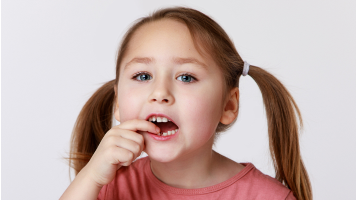 When to remove baby teeth, thereby making permanent teeth beautiful ...