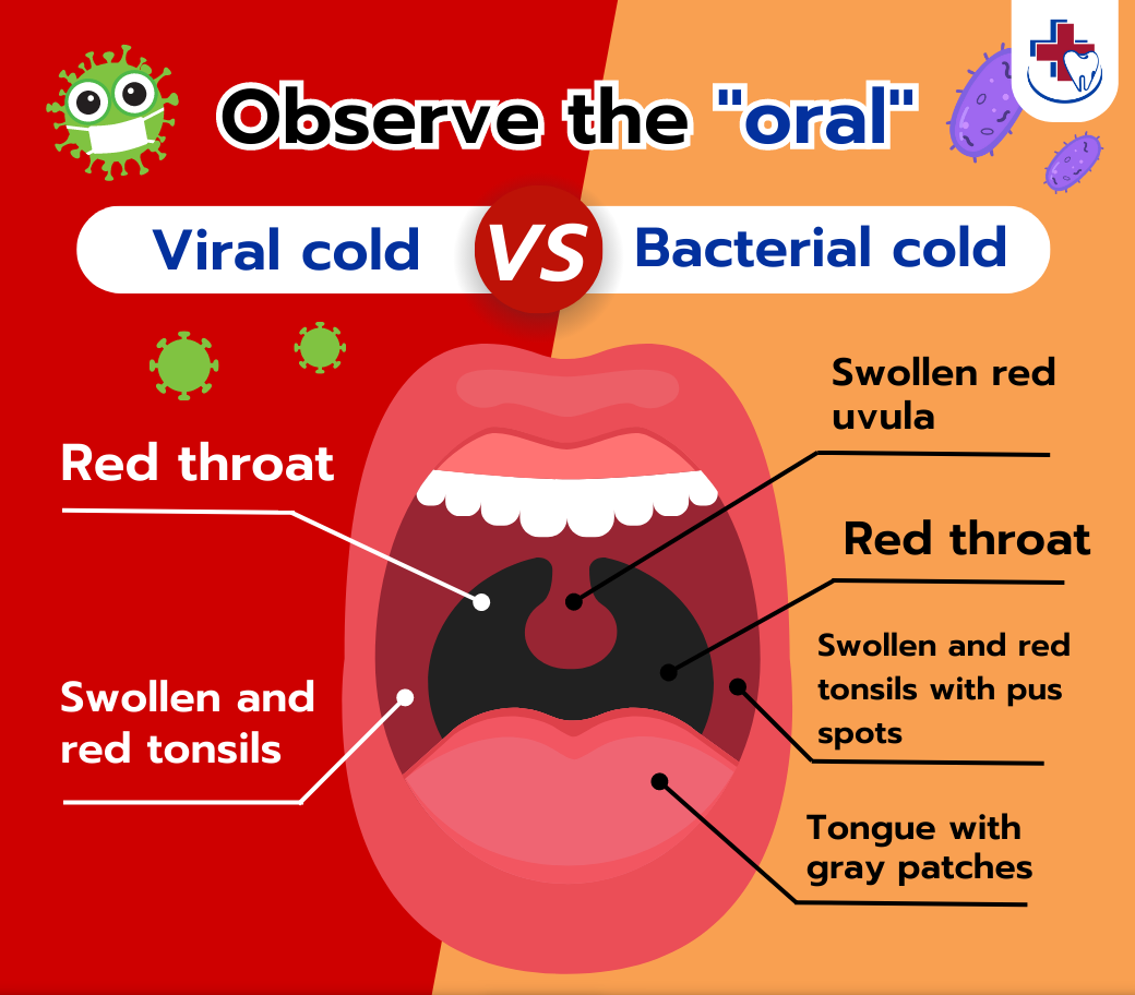 Viral Infection Vs Bacterial Infection Blood Test at Douglas Sexton blog