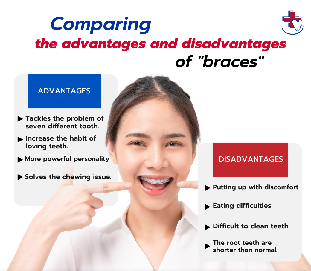 Comparing the advantages and disadvantages of "braces." | Chiangmai ...