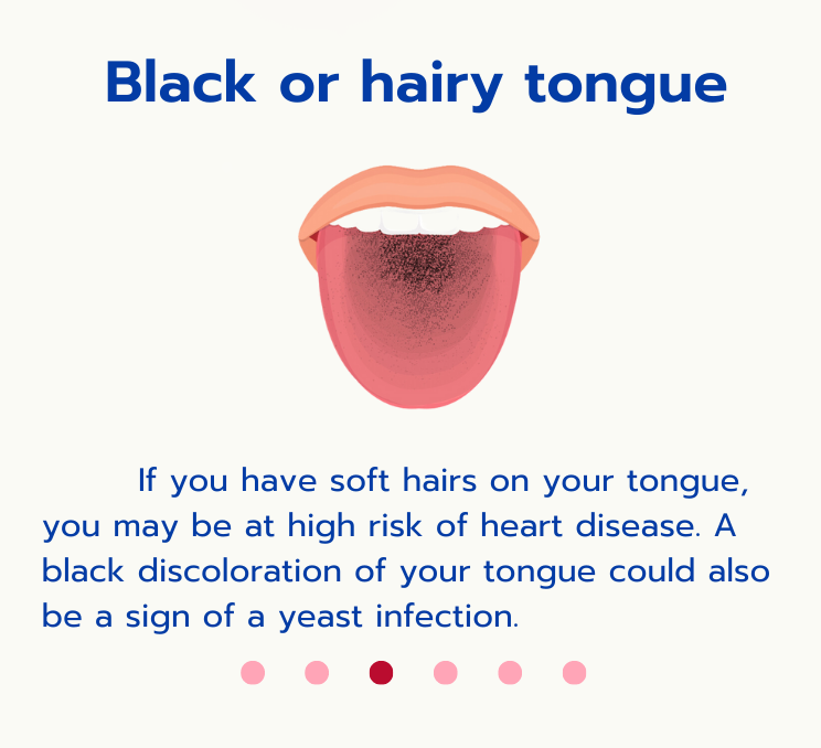 Did you know? tongue can tell disease | Chiangmai Hospital | Tel : 053 ...