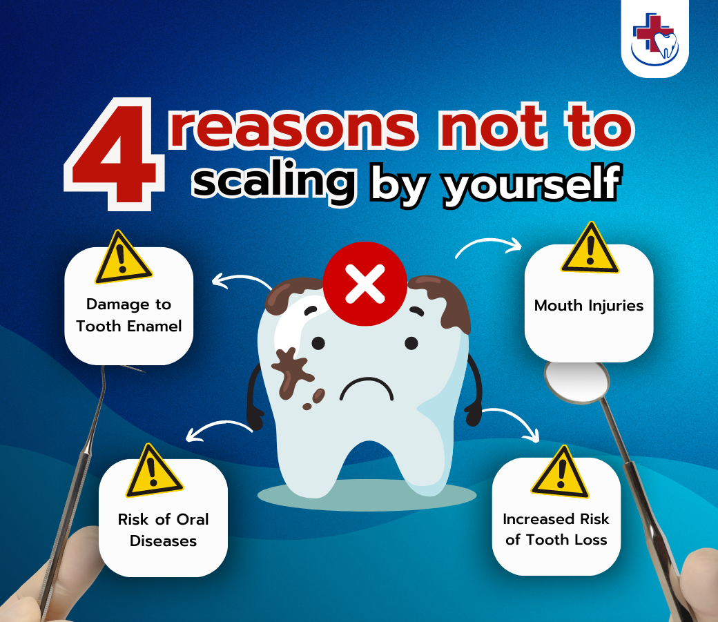 4 reasons not to "scaling" by yourself | Chiangmai Hospital | Tel : 053 ...
