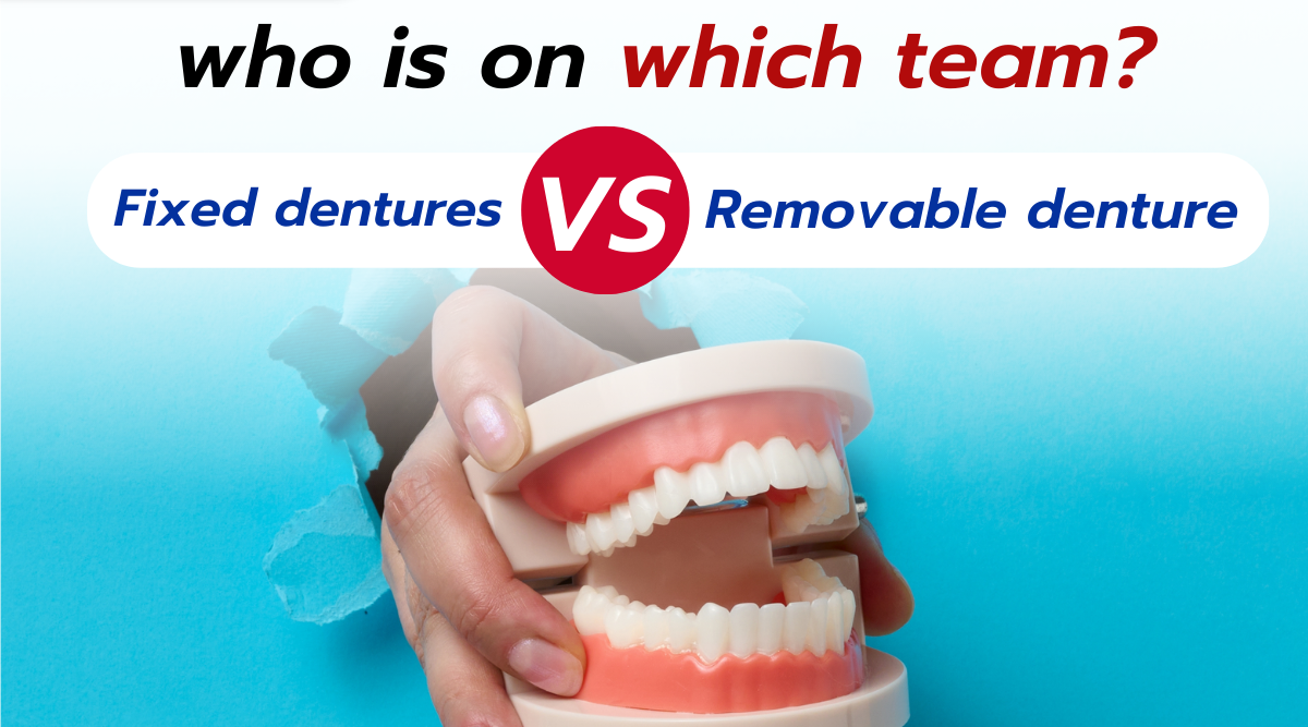 Fixed dentures Vs removable dentures, who is on which team? | Chiangmai ...