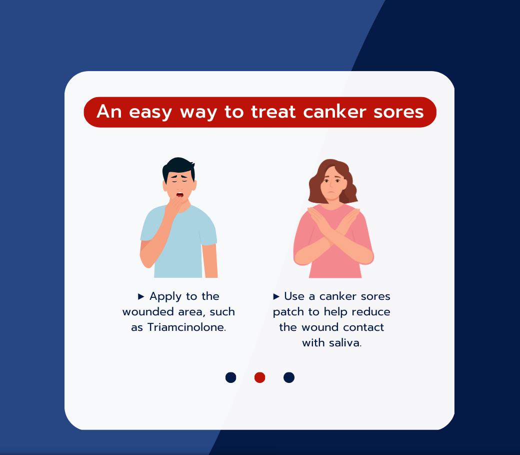 “Canker sores” a fussy problem that can be treated by yourself ...
