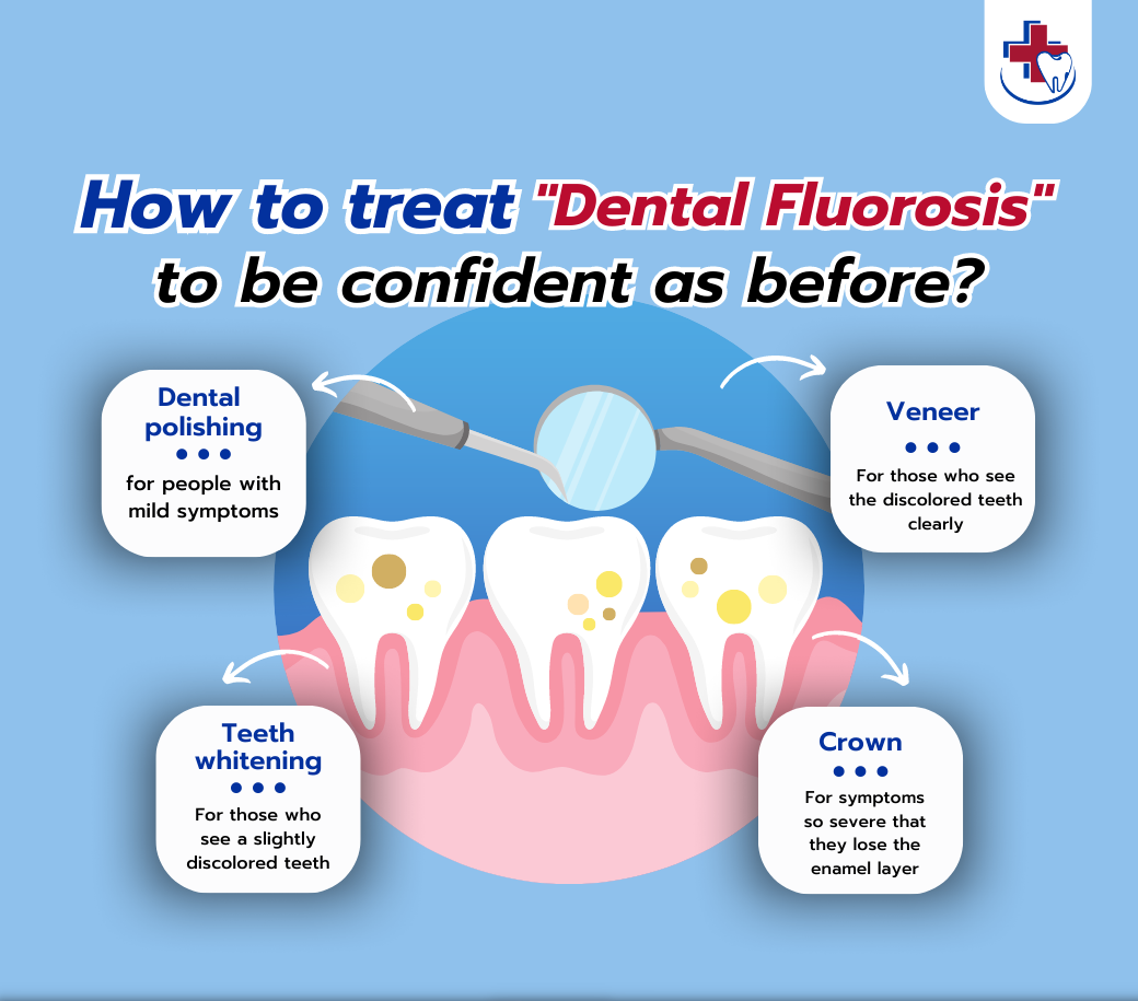 How to treat "Dental Fluorosis" to be confident as before? | Chiangmai ...